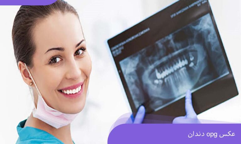 بررسی تمام کاربردهای عکس opg از عصب کشی تا اصلاح طرح لبخند- دندانپزشکی شبانه روزی تاج