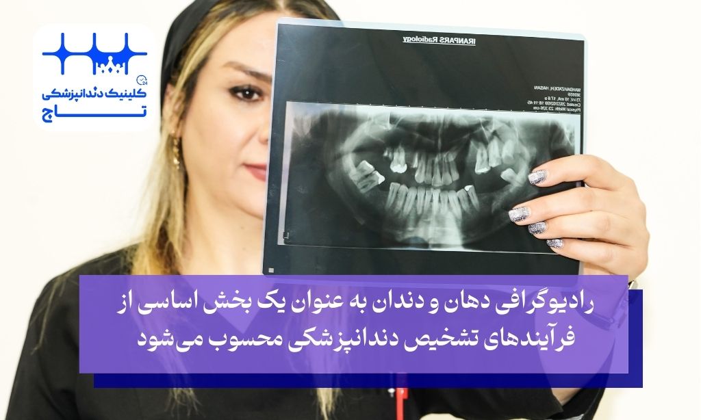 هزینه عکس دندان (OPG و CBCT) در سال 1404 چقدر است؟ - دندانپزشکی شبانه روزی تاج
